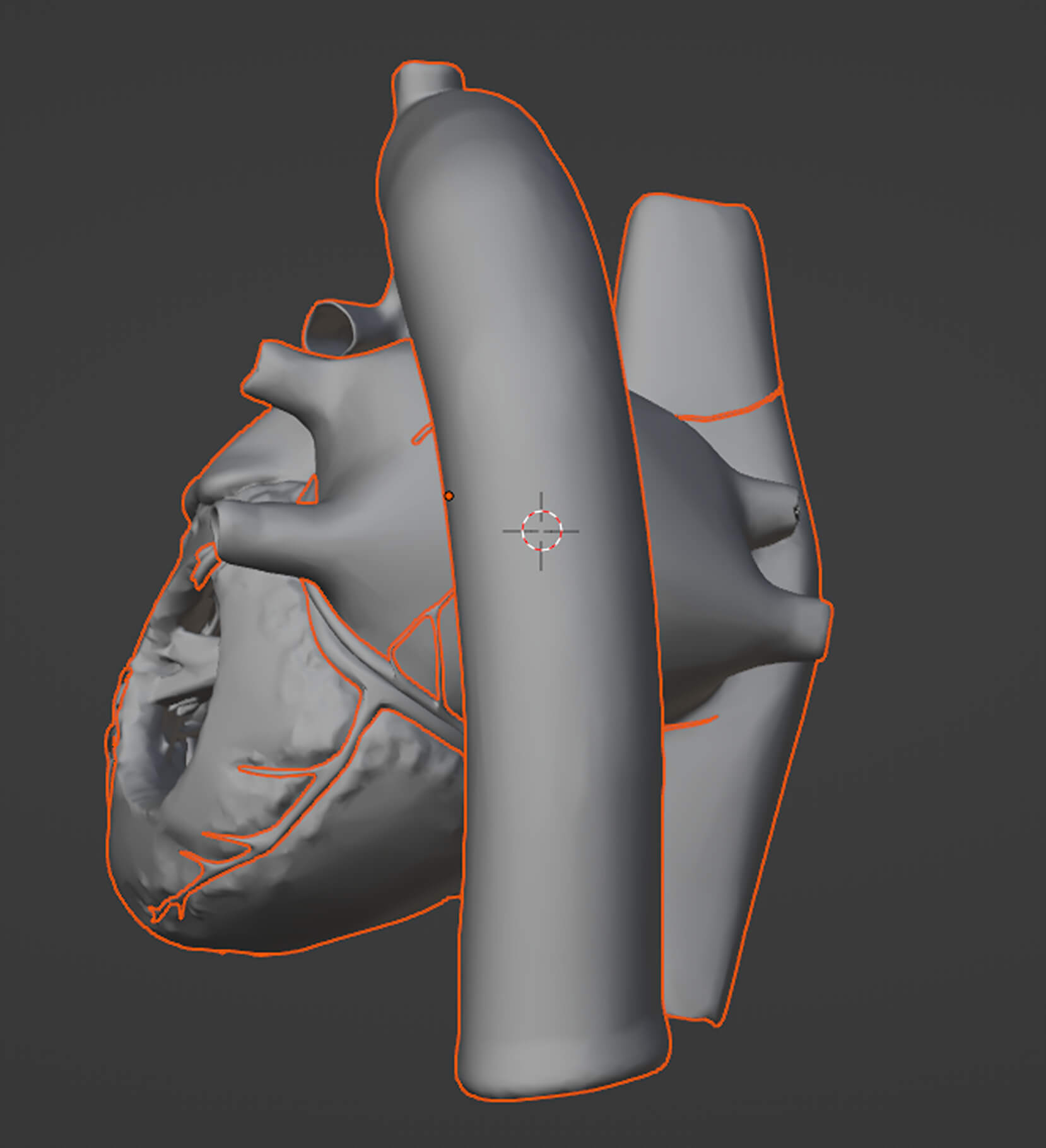 3D Model of Heart With Tetralogy of Fallot (Tof) by azekapeka