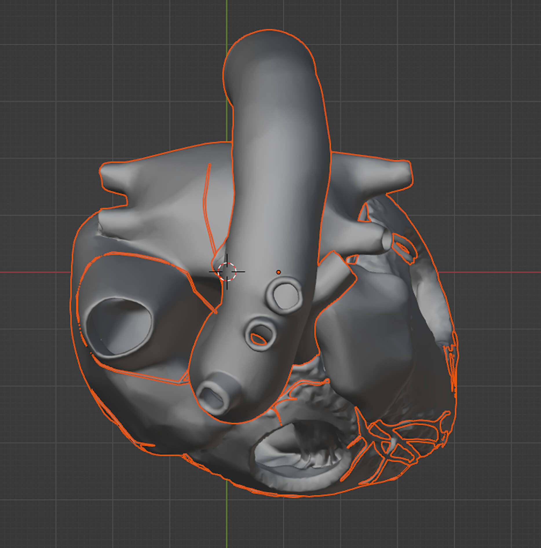 3D Model of Heart With Tetralogy of Fallot (Tof) by azekapeka