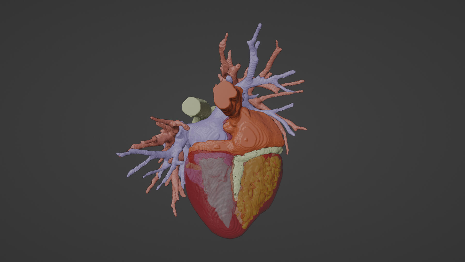 3D Model of Human Heart With Double Aortic Arch by azekapeka