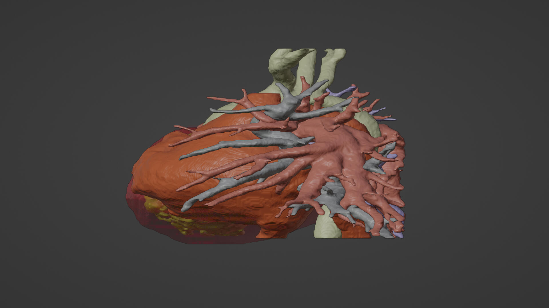 3D Model of Human Heart With Mirror Dextrocentric by azekapeka