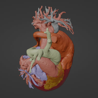 3D Model of Human Heart With Mirror Dextrocentric by azekapeka