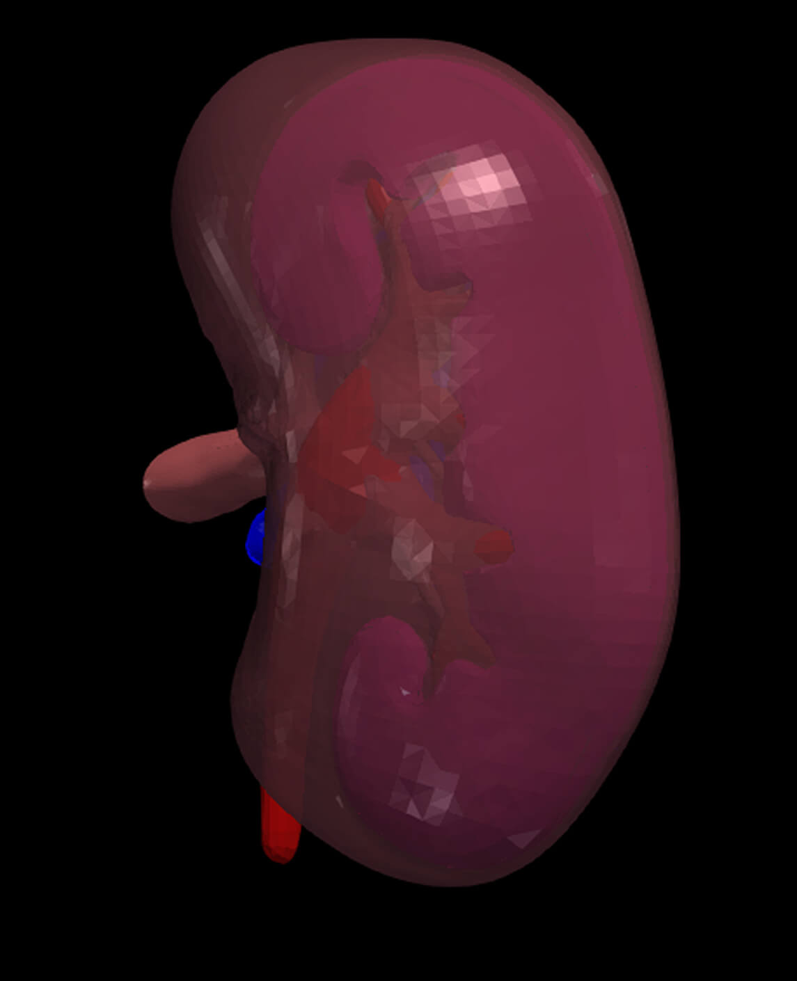 3D Model of Human Kidney Cross Section by azekapeka