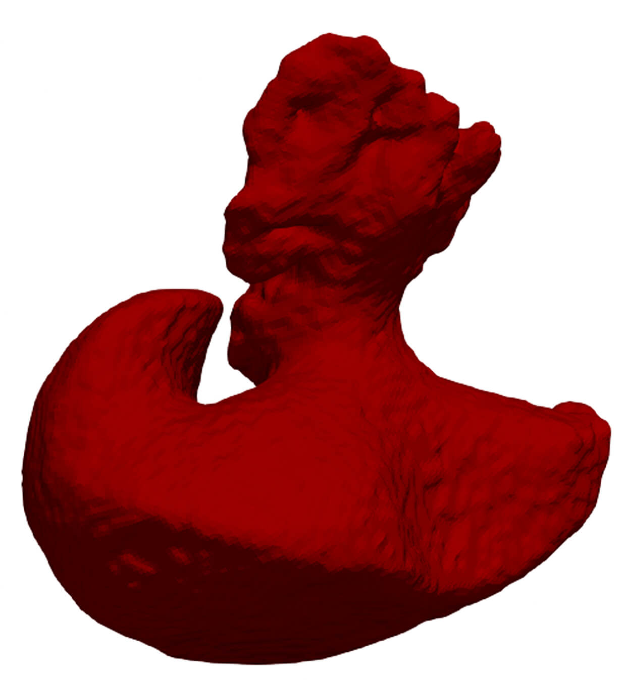 3D Model of Left Atrial Appendage by azekapeka