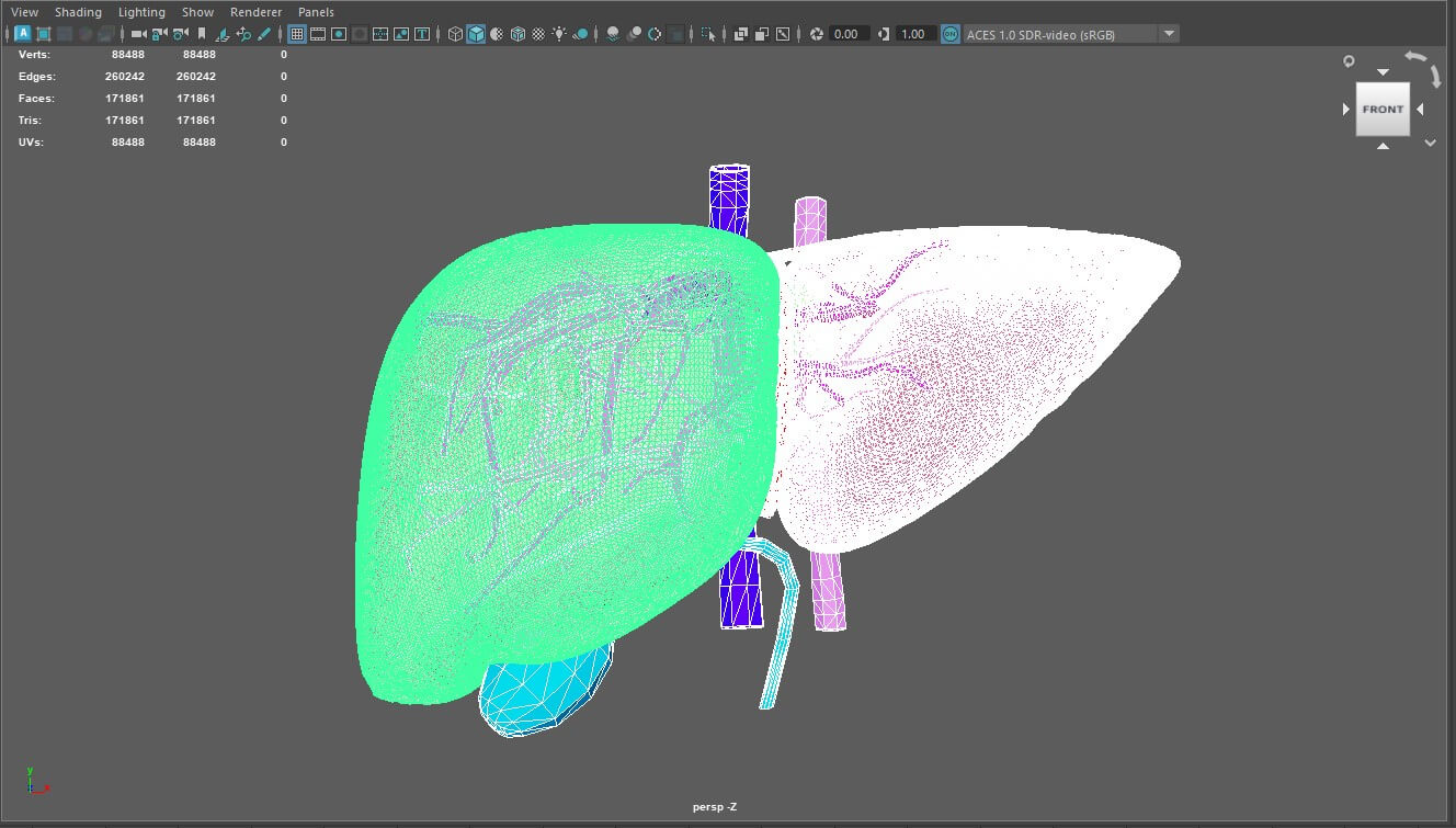 3D Model of Liver With Cirrhosis by azekapeka