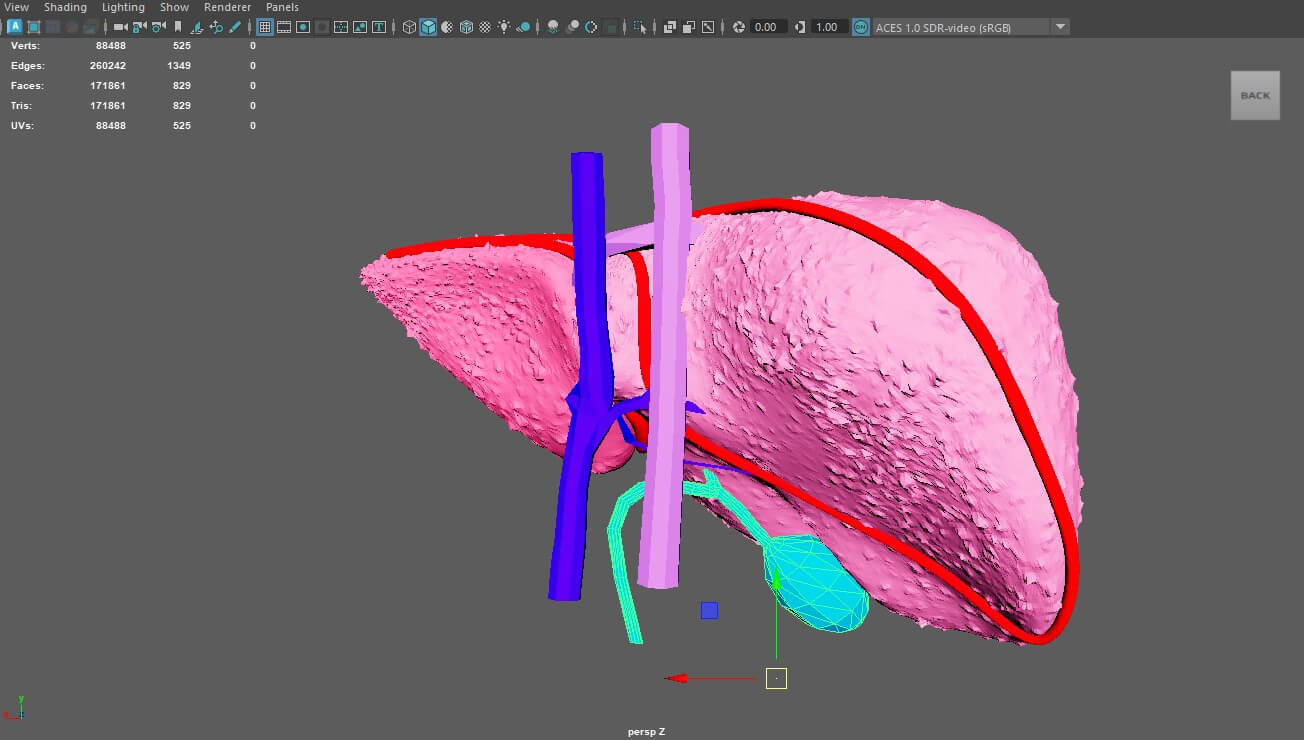 3D Model of Liver With Cirrhosis by azekapeka