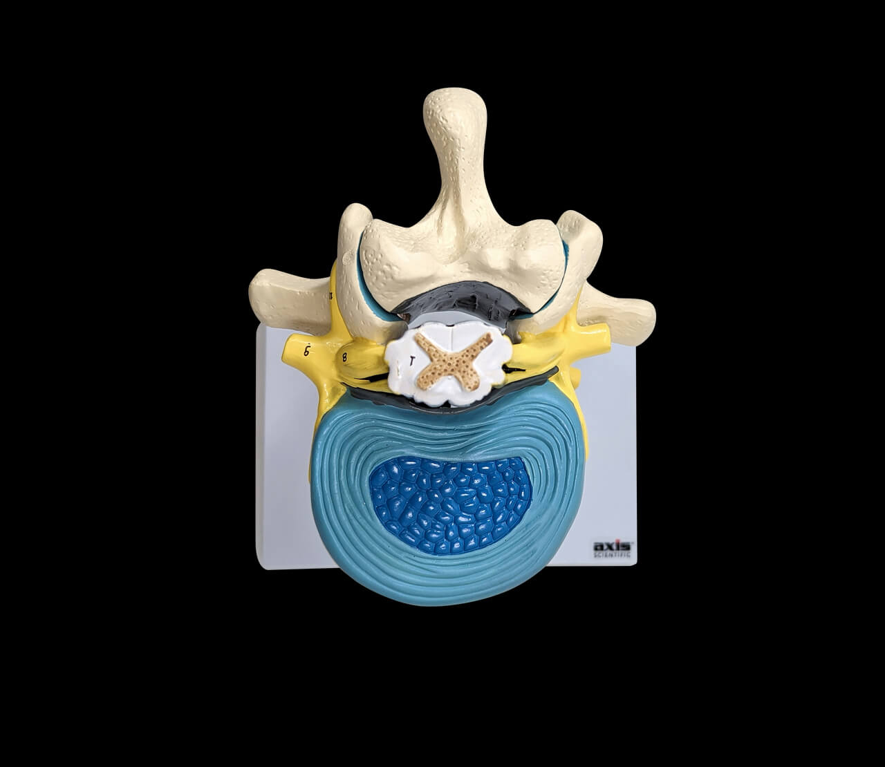 3D Model of Lumbar Vertebrae With Spinal Cord and Nerves by azekapeka