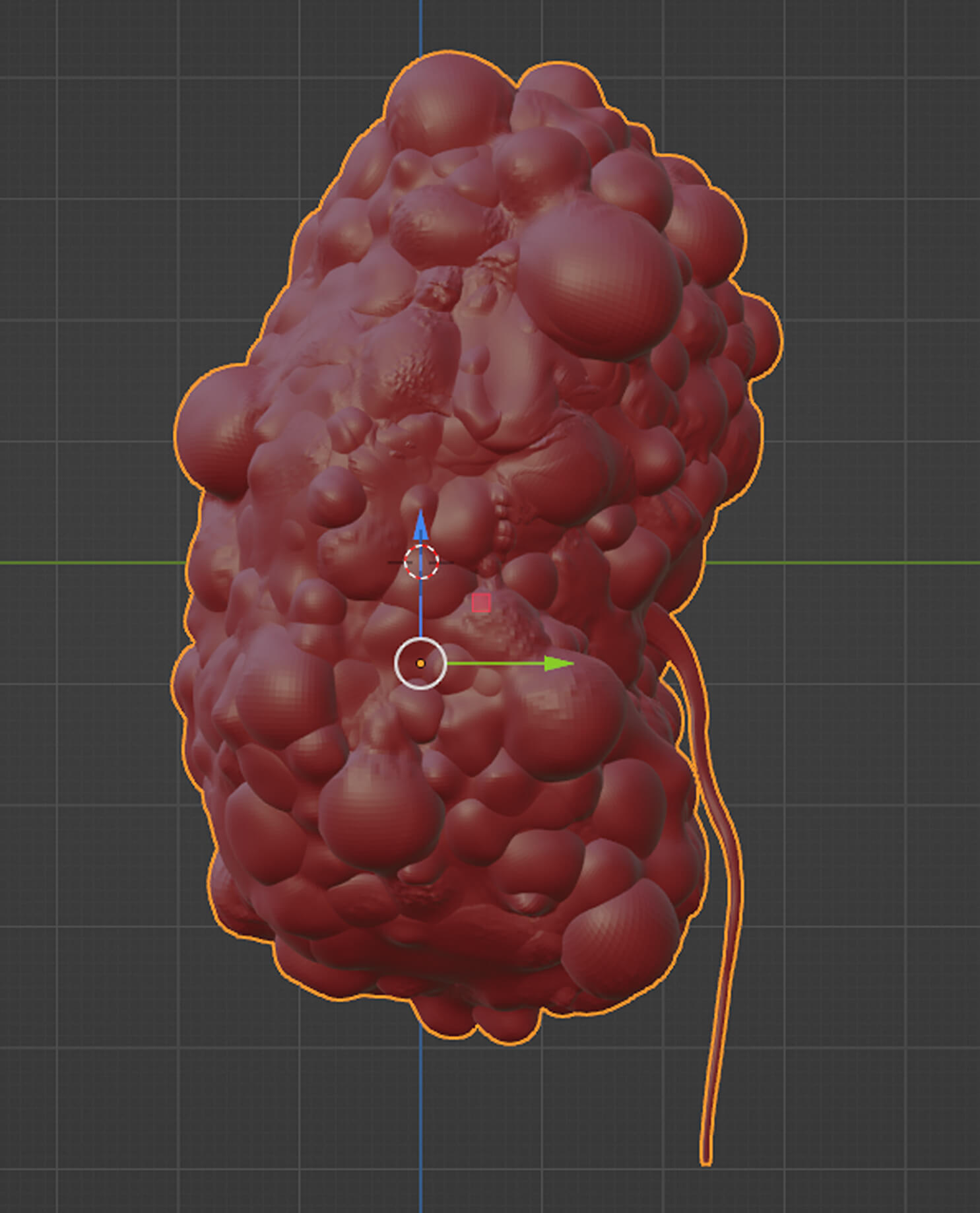 3D Model of Polycystic Kidney by azekapeka