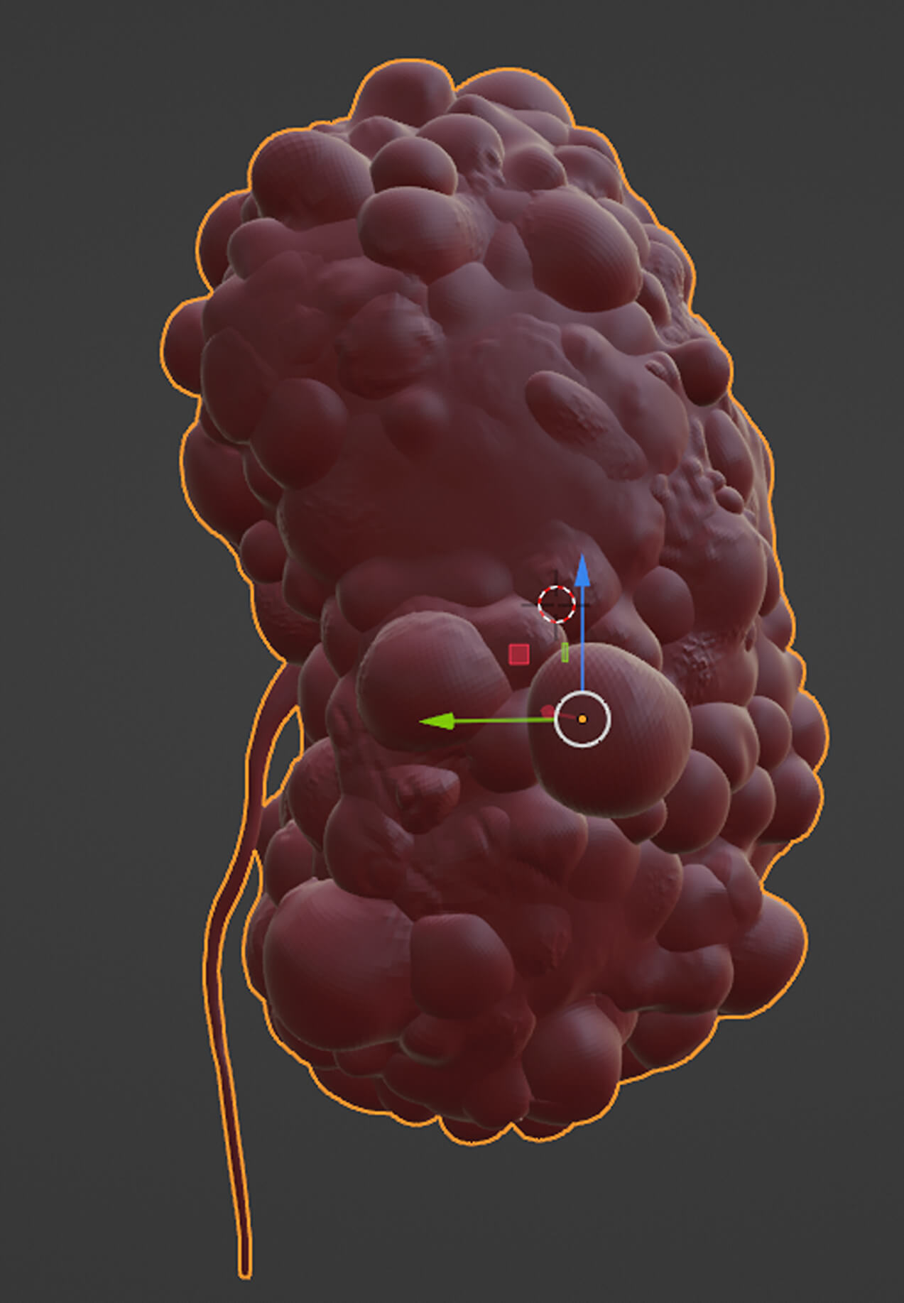 3D Model of Polycystic Kidney by azekapeka