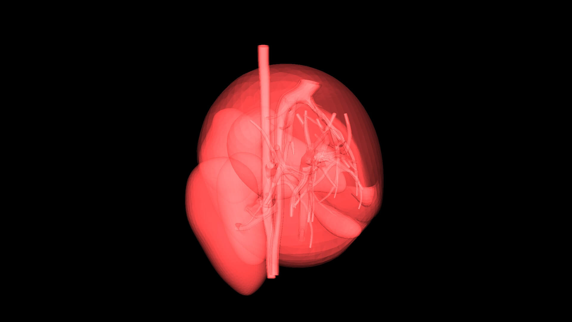 3D Model of Pre- and Post- Operative Liver by azekapeka