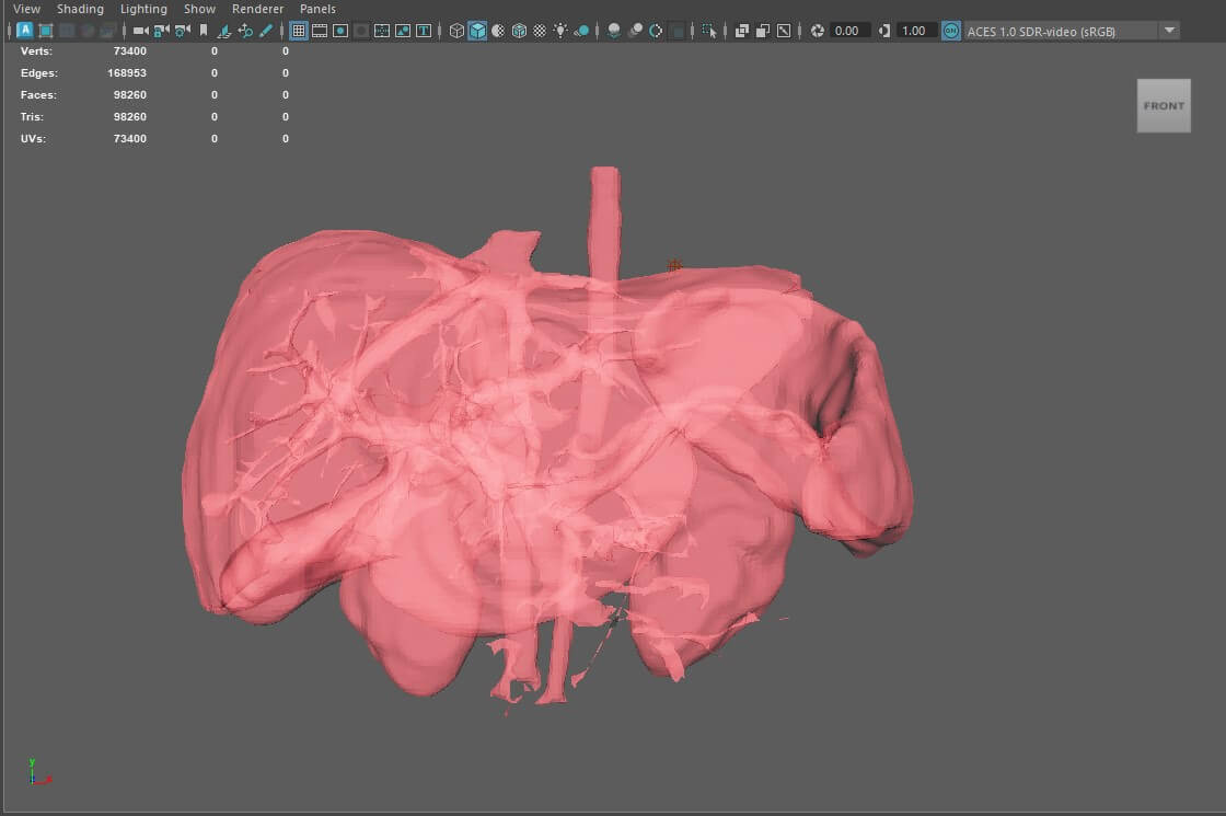 3D Model of Pre- and Post- Operative Liver by azekapeka