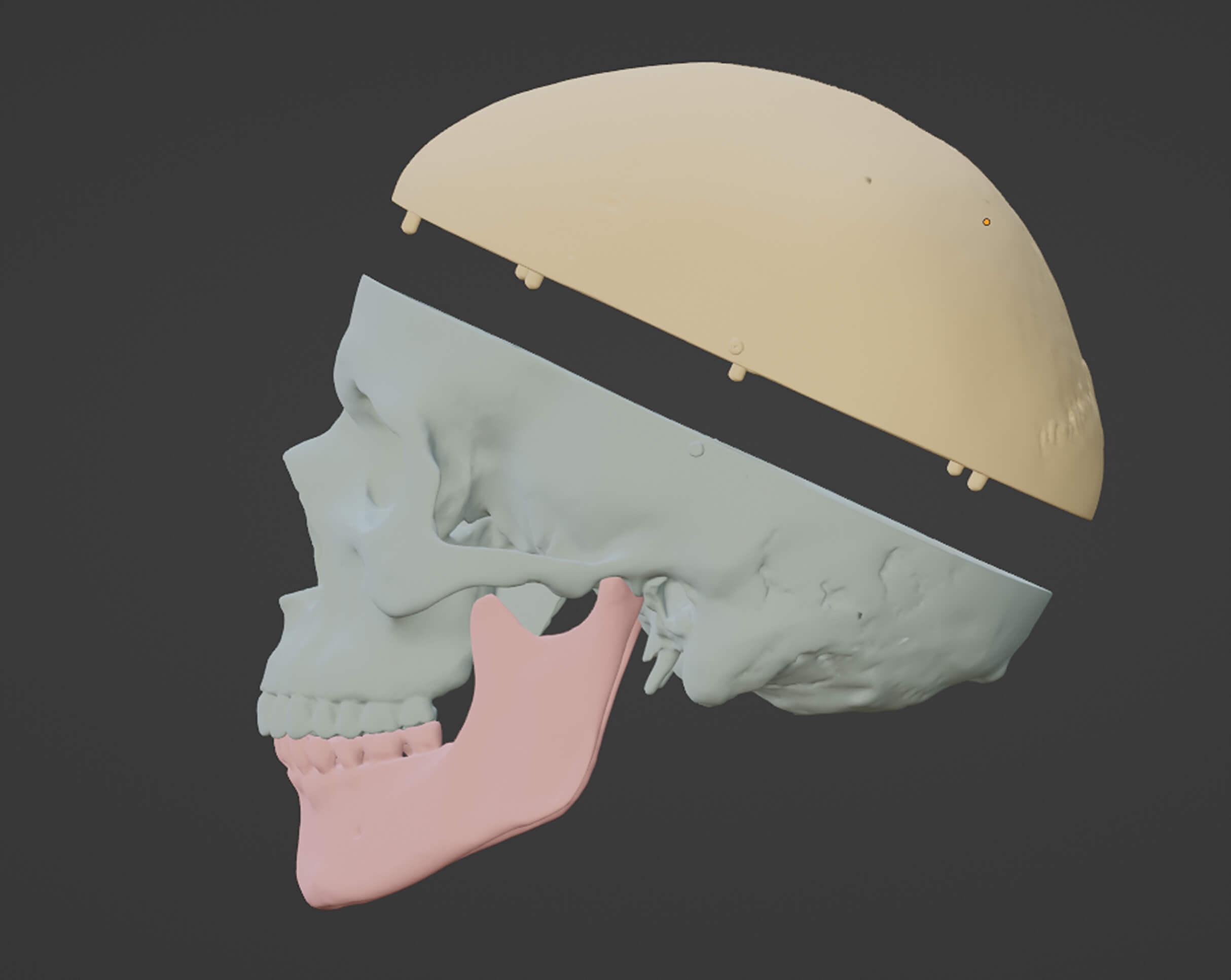 3D Model of Skull, Skull Cap and Mandible by azekapeka