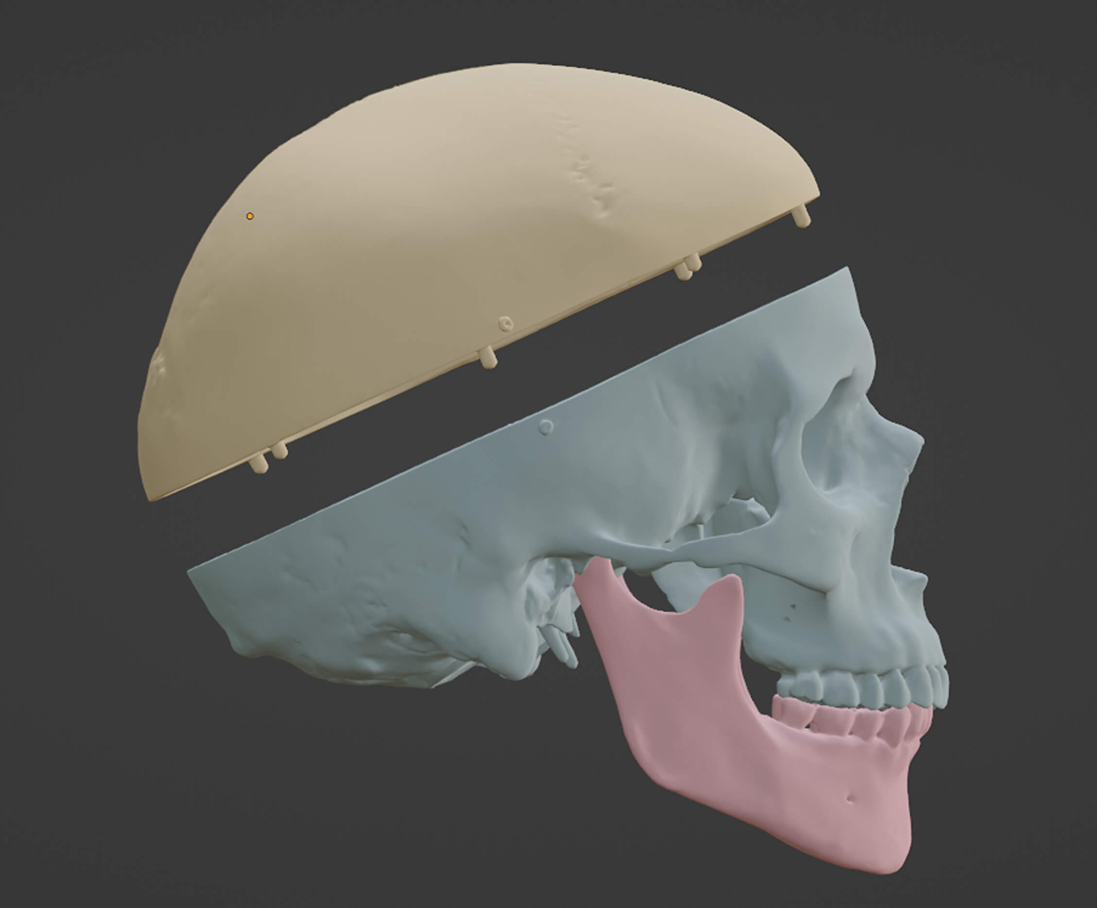 3D Model of Skull, Skull Cap and Mandible by azekapeka