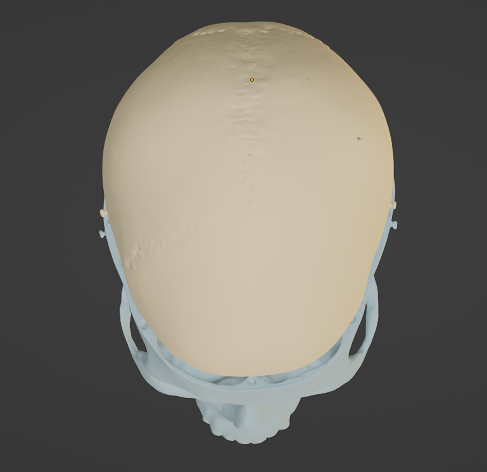 3D Model of Skull, Skull Cap and Mandible by azekapeka