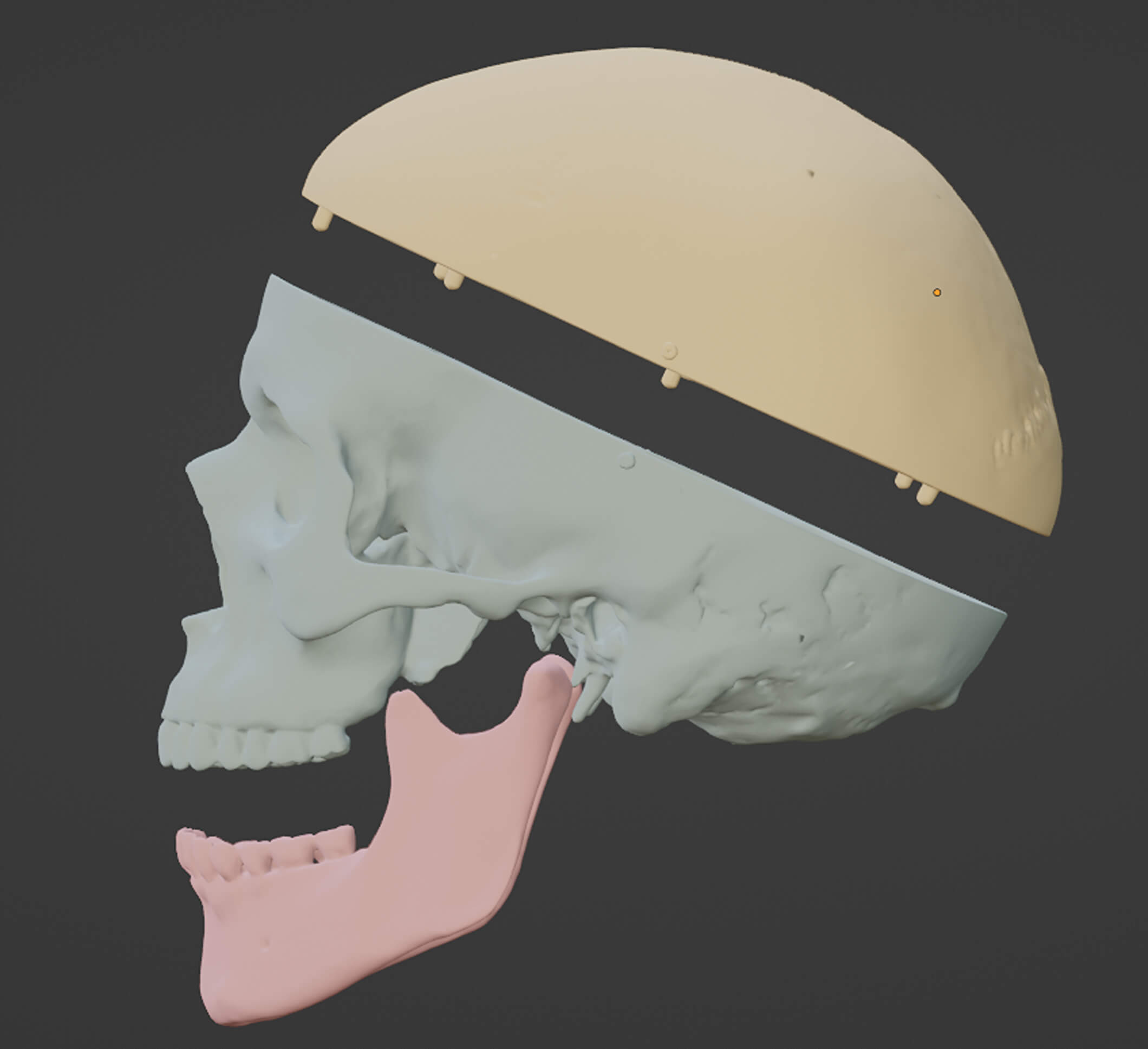 3D Model of Skull, Skull Cap and Mandible by azekapeka