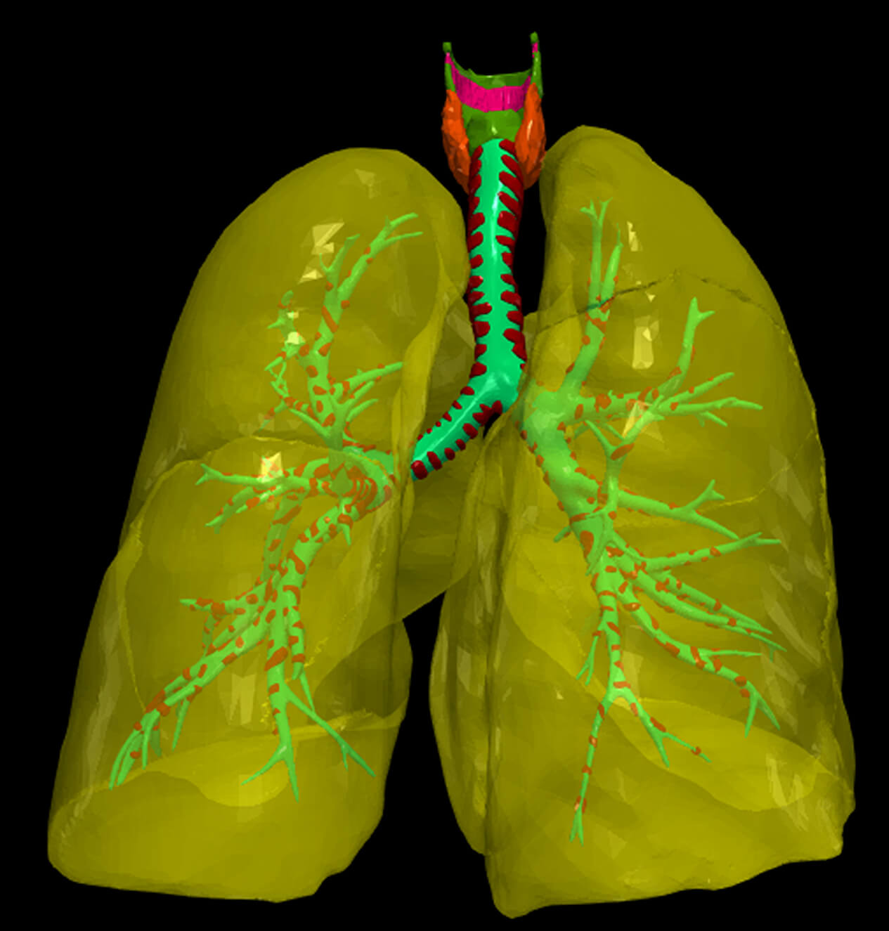 3D Model of The Lungs Airways by azekapeka