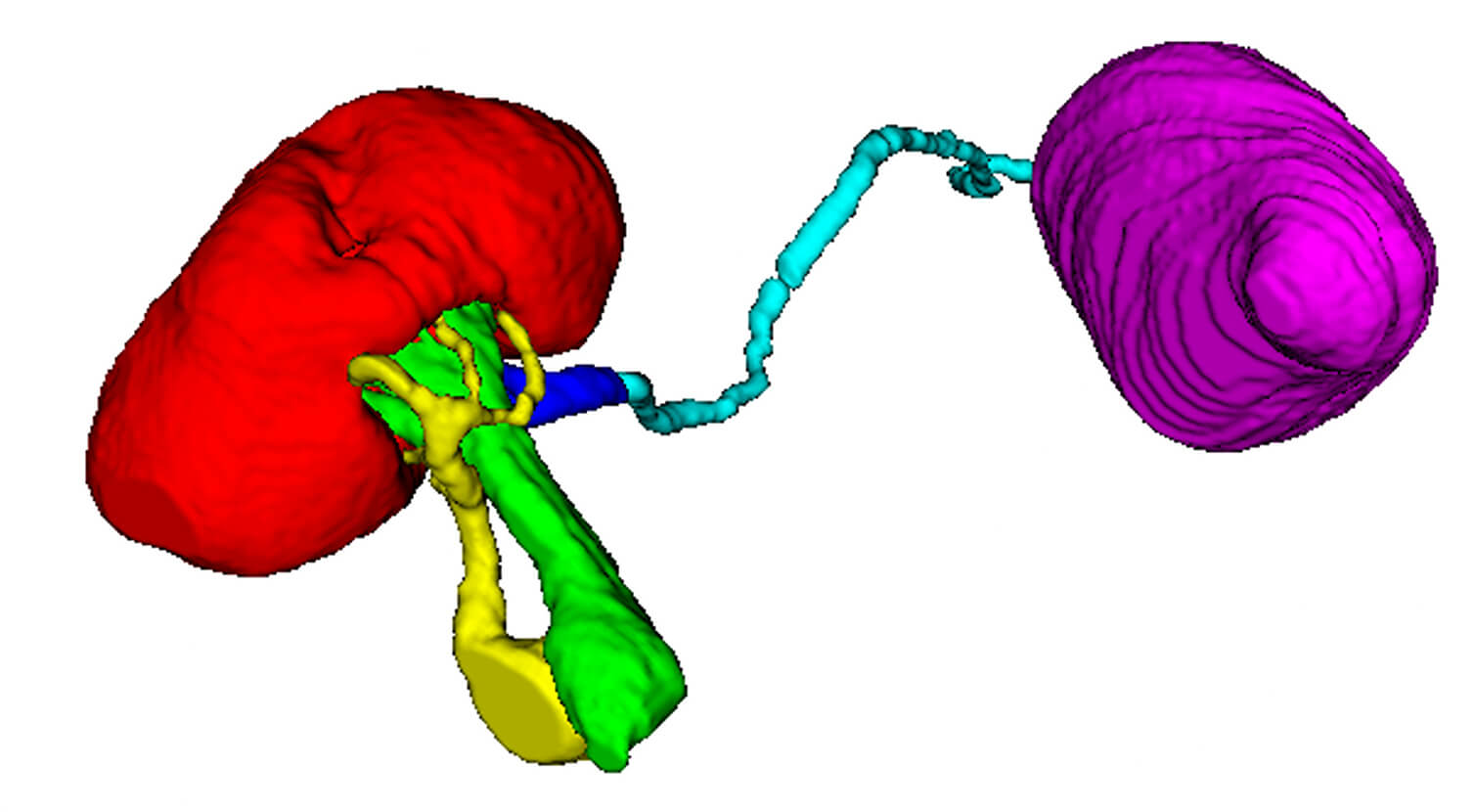 3D Model of Urinary System - Generated From Real Patient by azekapeka
