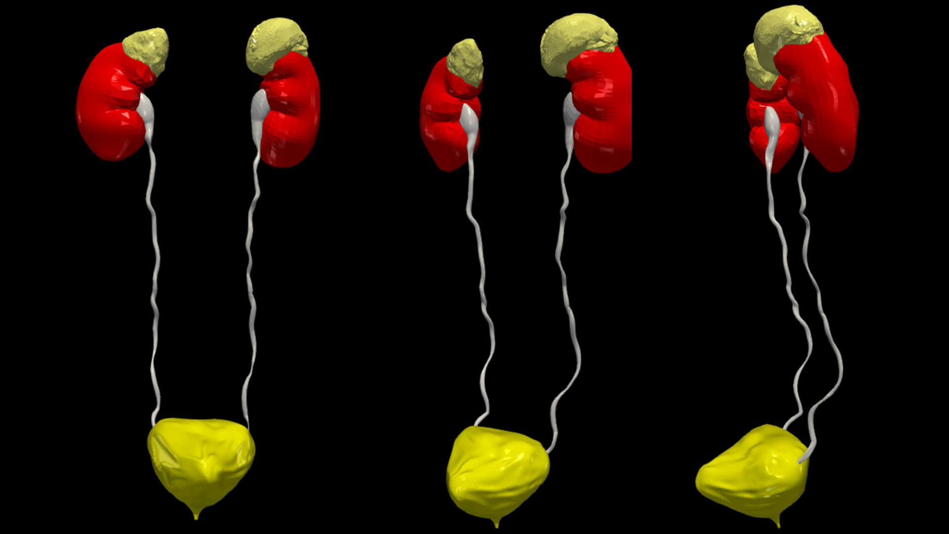 3D Model of Urinary System V2 by azekapeka