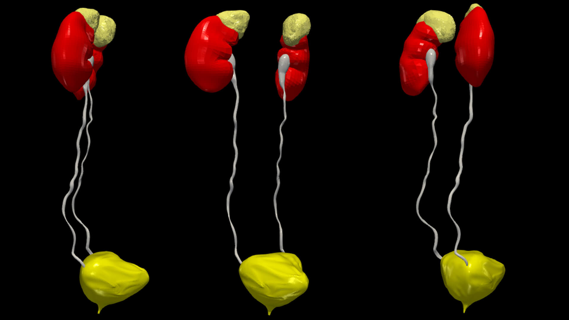 3D Model of Urinary System V2 by azekapeka