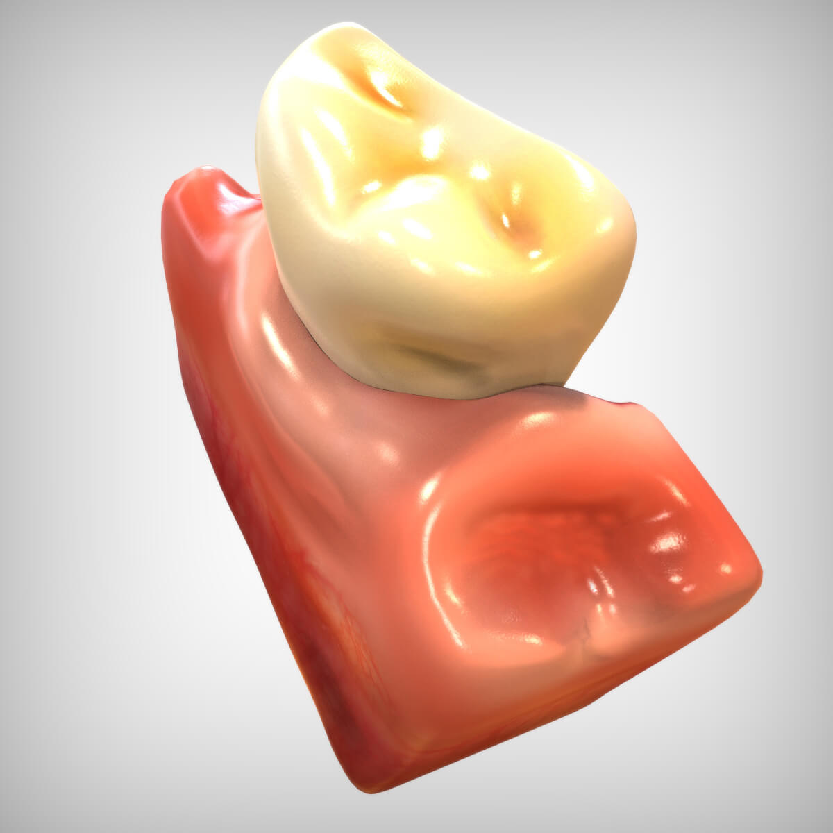 Tooth Cutaway - 3D Model by AzulUtak