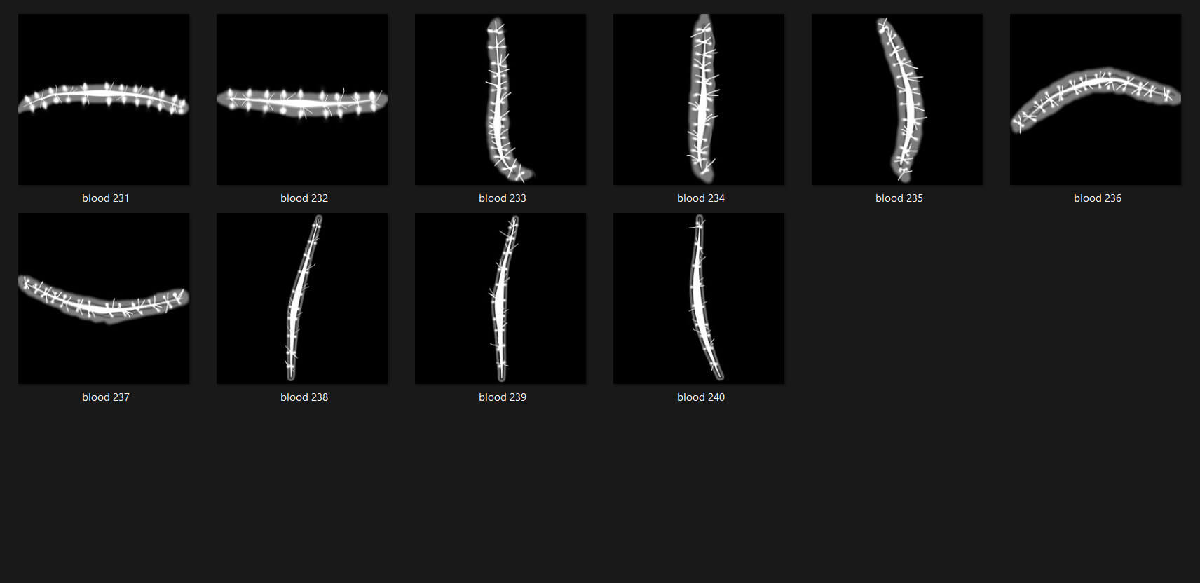 Blood Displacement and Alpha Patterns PNG and JPG 2K Size - 3D Texture ...