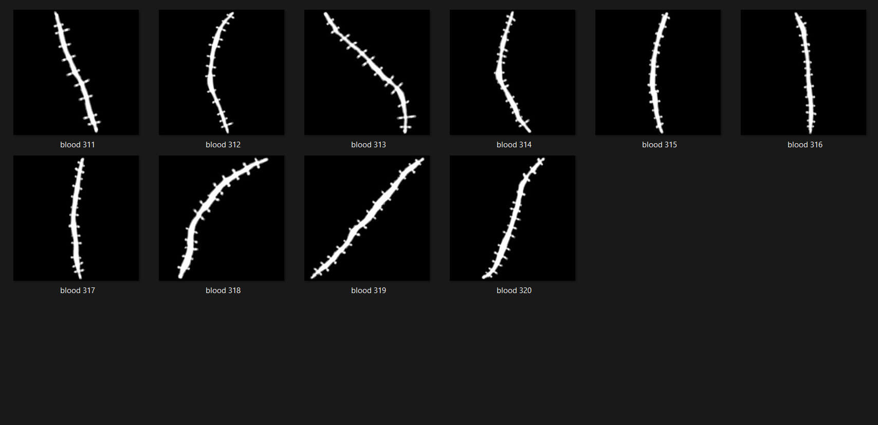 Blood Displacement and Alpha Patterns PNG and JPG 2K Size - 3D Texture ...