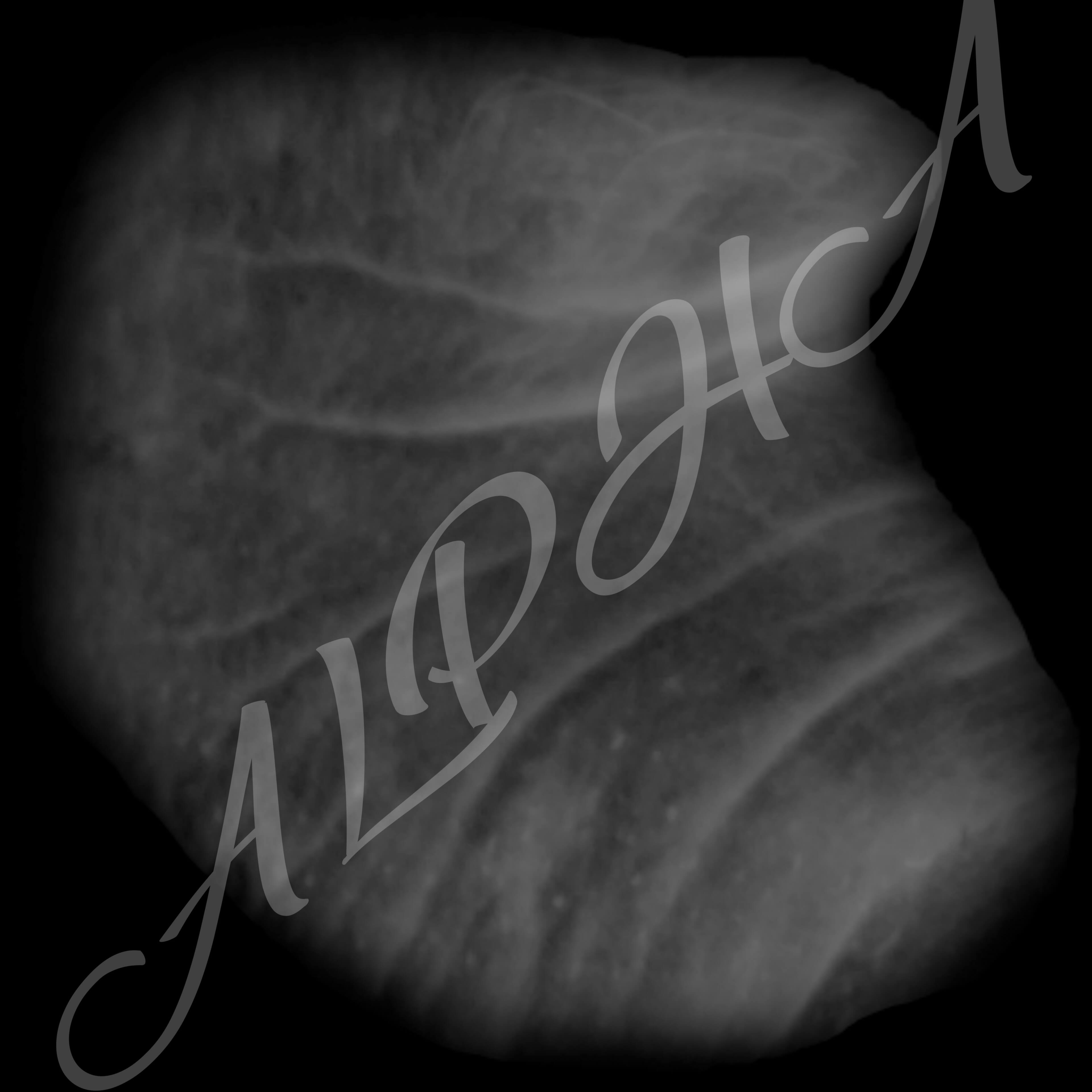 Skin 240 Alpha Patterns 4K Size Full Pack - 3D Texture by chiraggg_02