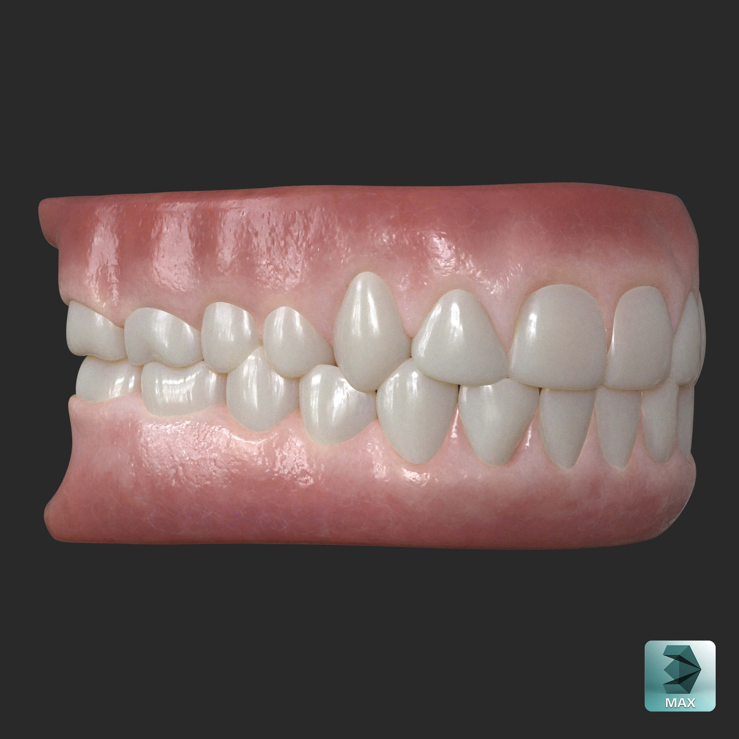 Teeth and Gums Bundle by criismora
