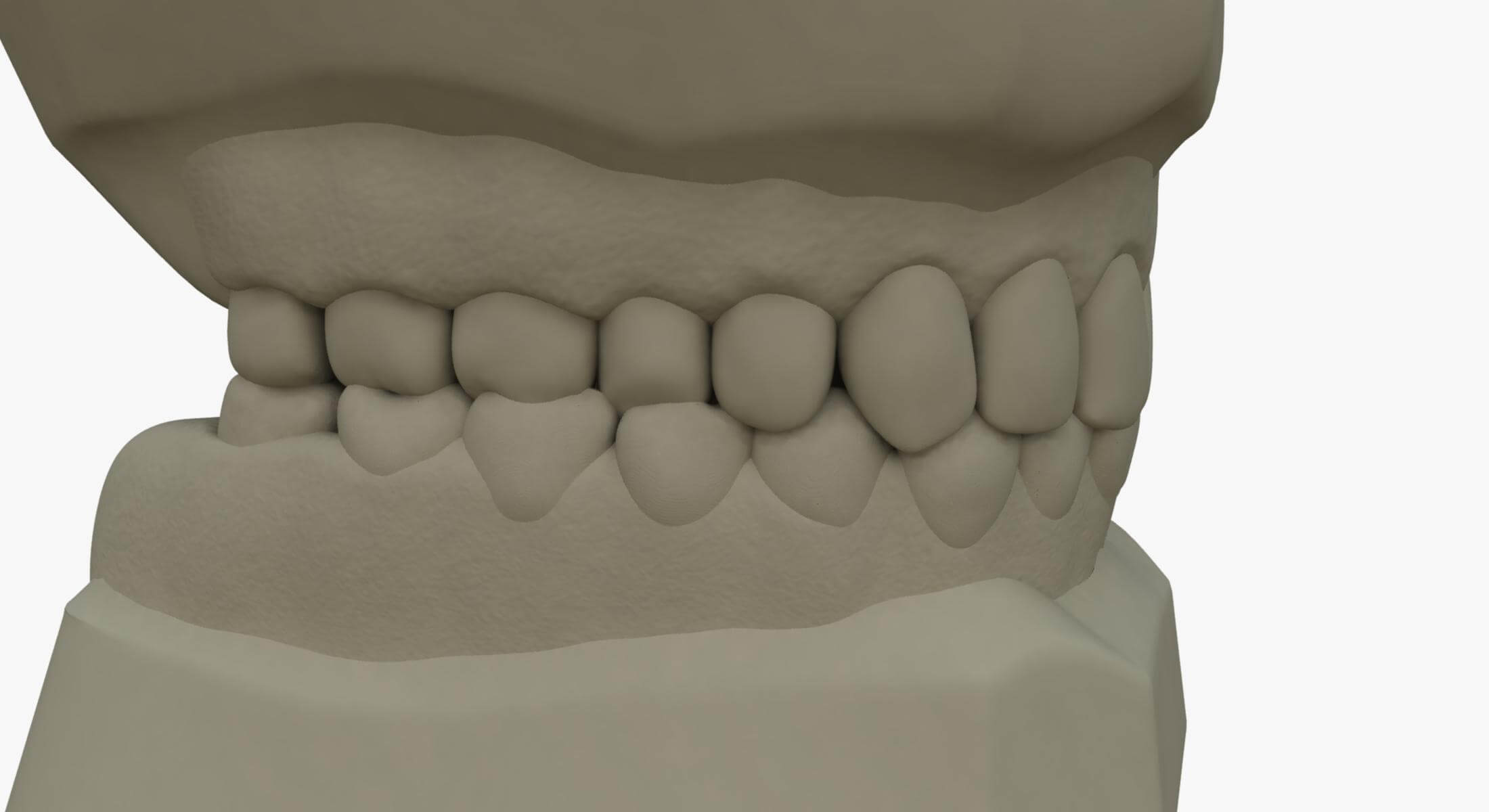 Teeth Mold - 3D Model by dcbittorf