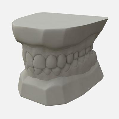 Teeth Mold - 3D Model by dcbittorf