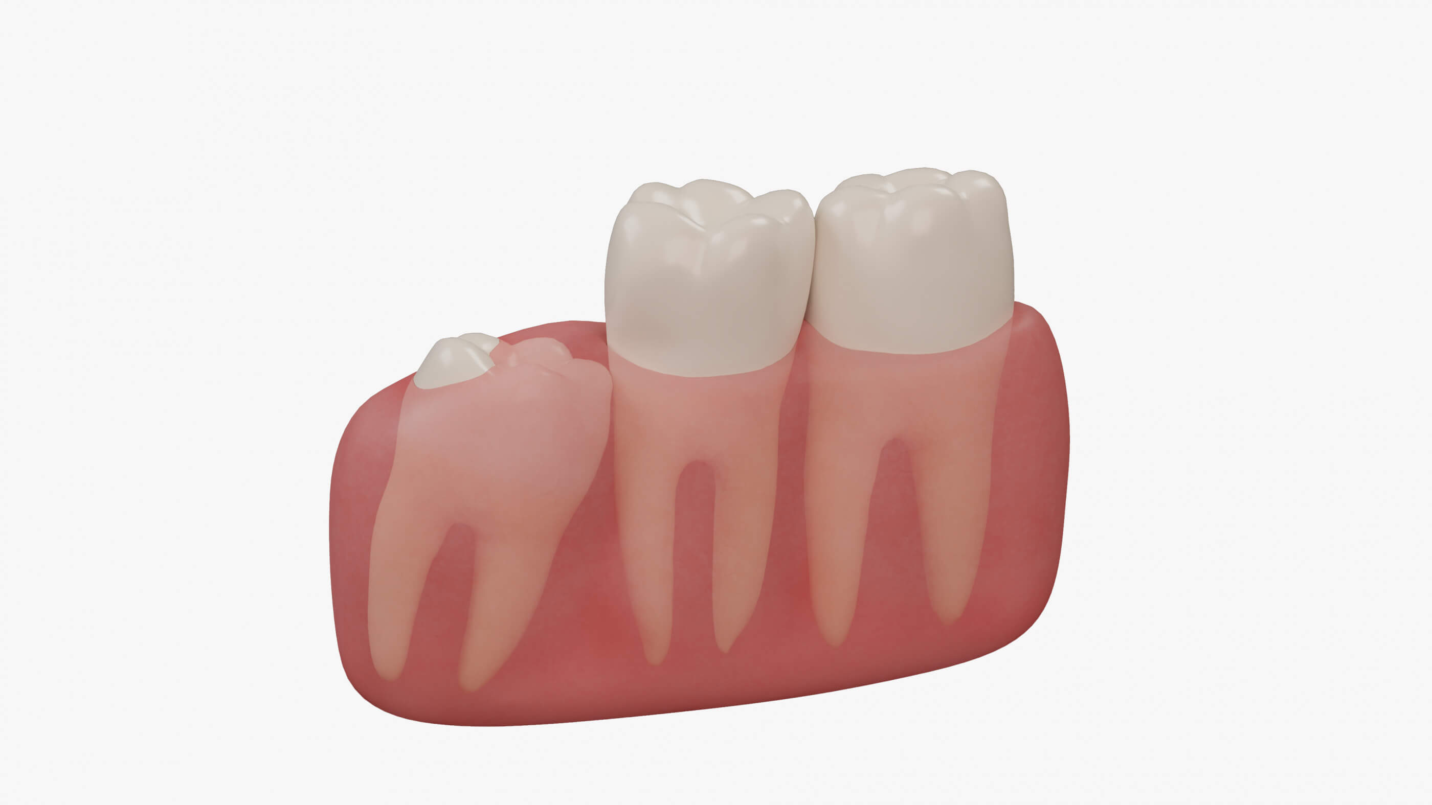 Molar Tooth 3d