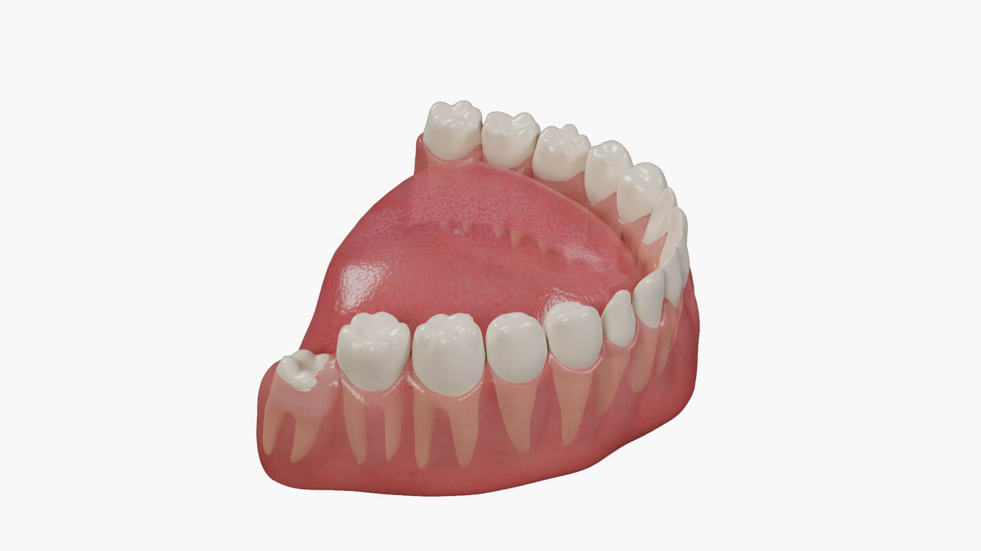 Impacted Wisdom Teeth - 3D Model by esfey