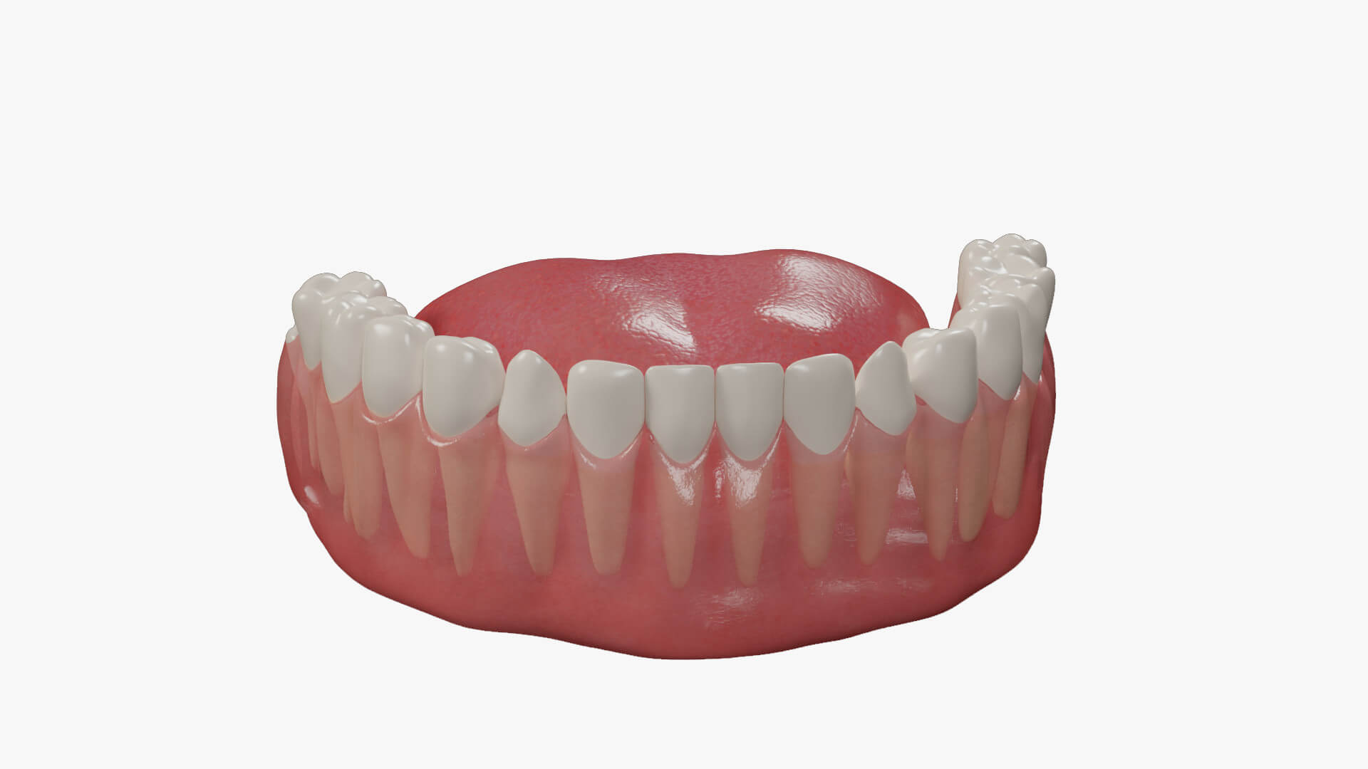 Impacted Wisdom Teeth - 3D Model by esfey