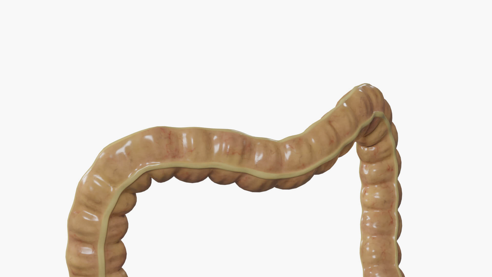 Human Large Intestine