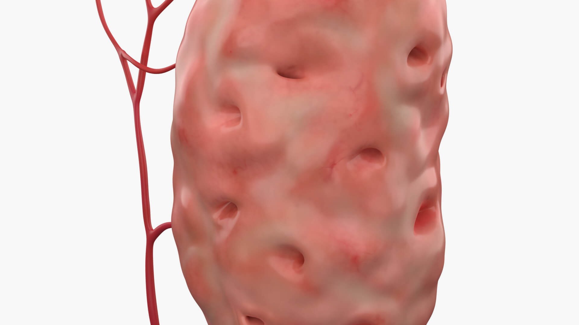 Palatine Tonsil - 3D Model by esfey