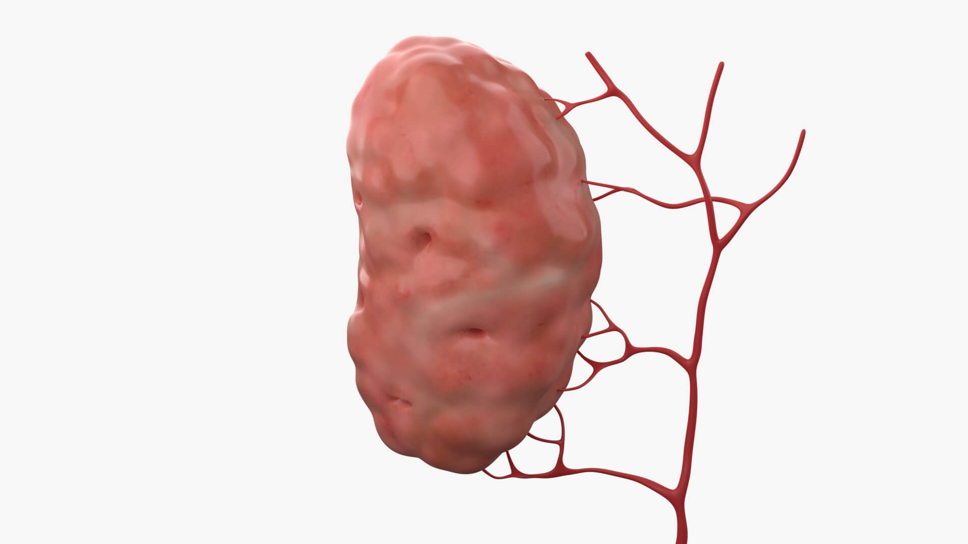 Palatine Tonsil - 3D Model by esfey