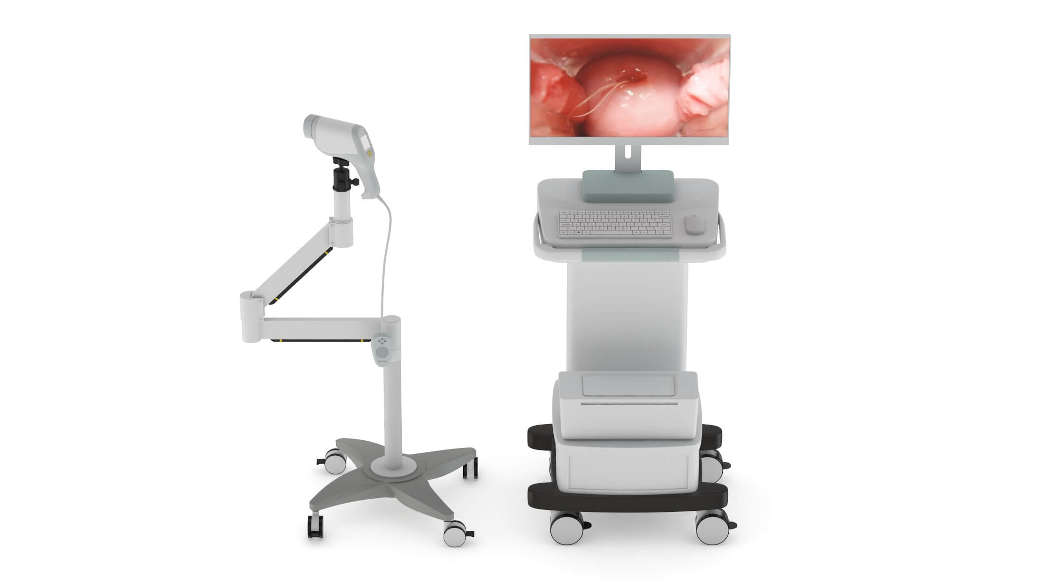 Medical Colposcopes - 3D Model by frezzy