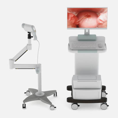 Medical Colposcopes - 3D Model by frezzy