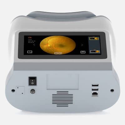 Medical Fully Automatic Fundus Camera - 3D Model by frezzy