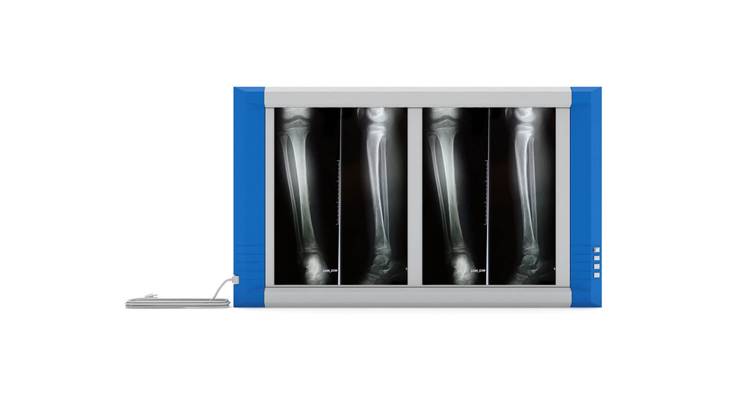 Medical X-Ray Light Box 3D Model by frezzy