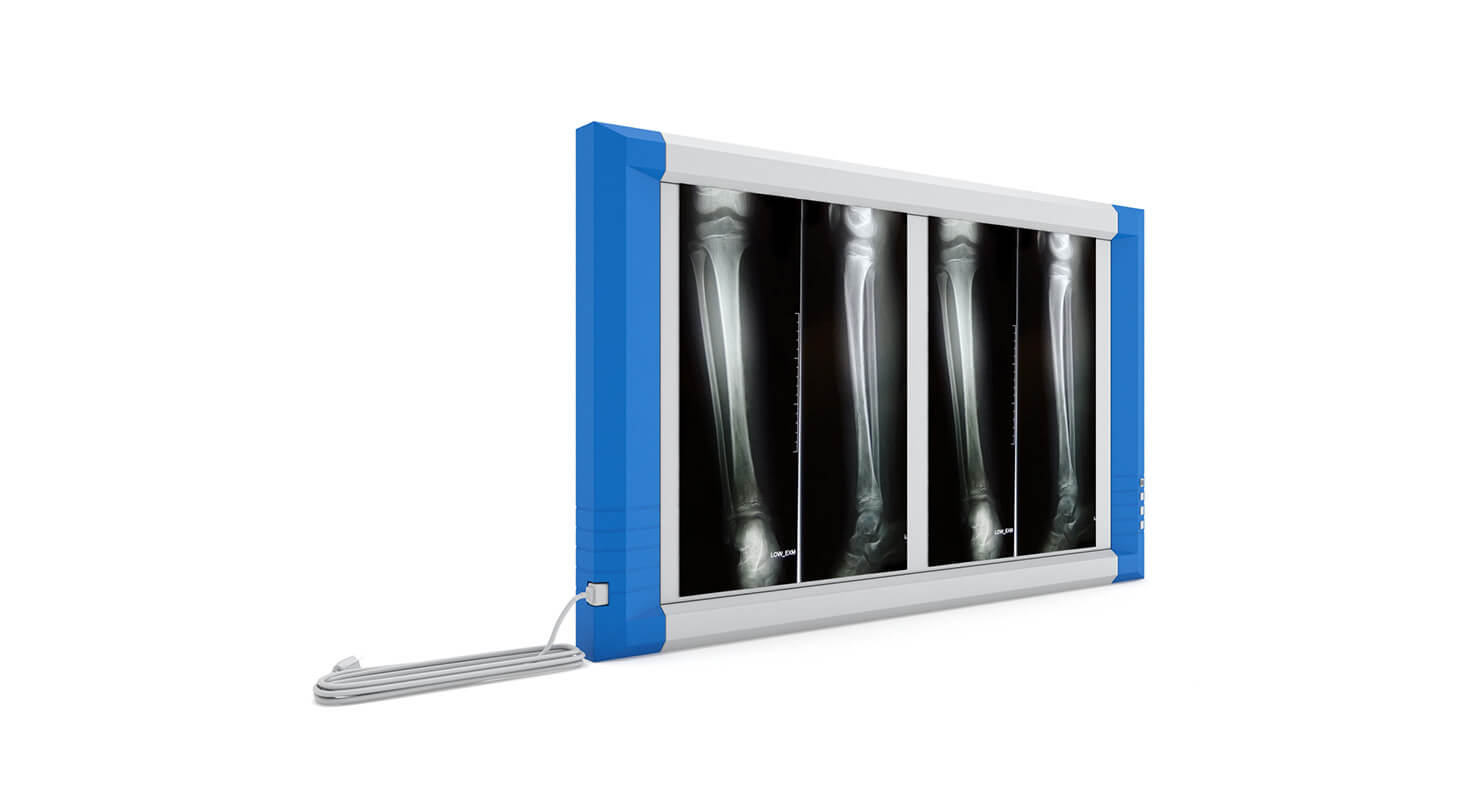 Medical X-Ray Light Box 3D Model by frezzy