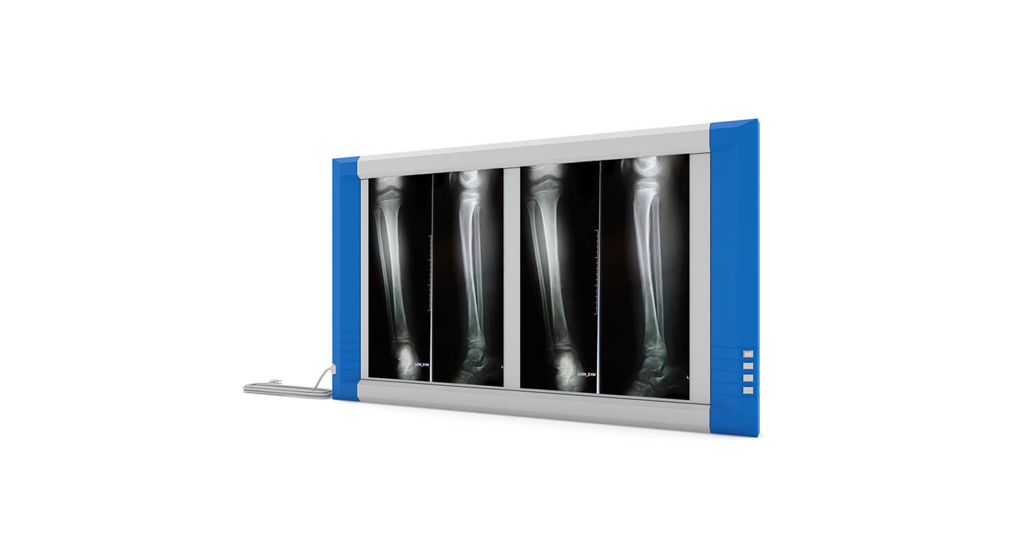 Medical X-Ray Light Box 3D Model by frezzy