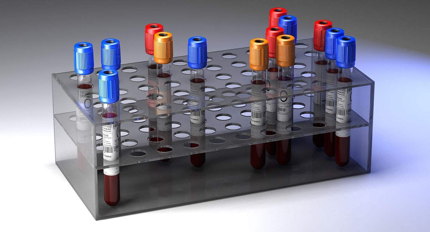 Blood Sample Rack - 3D Model by Giimann