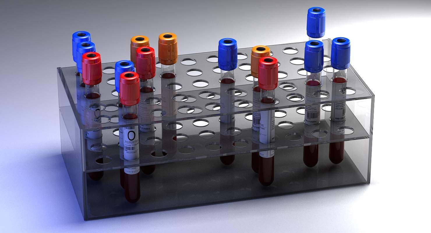 Blood Sample Rack - 3D Model by Giimann