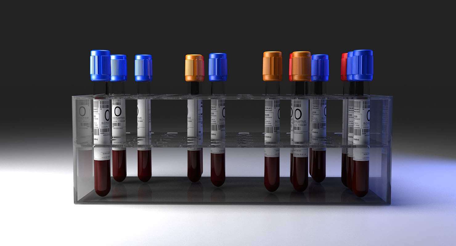 Blood Sample Rack - 3D Model by Giimann