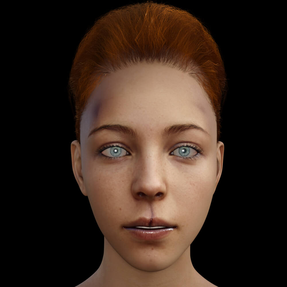 Cleft Lip Portraits 3D Render, Digital Art by guy91600