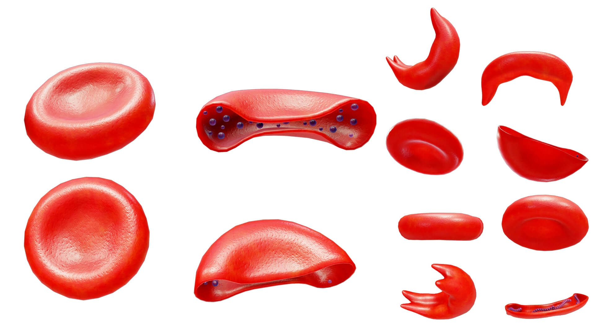 Cross Section of Normal Vs Sickle Red Blood Cell - 3D Model by h3ydari96