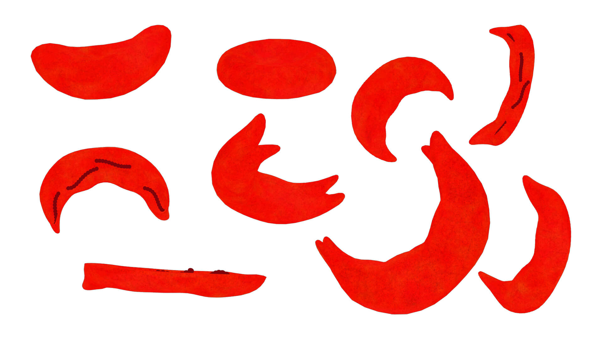 Cross Section of Normal Vs Sickle Red Blood Cell - 3D Model by h3ydari96