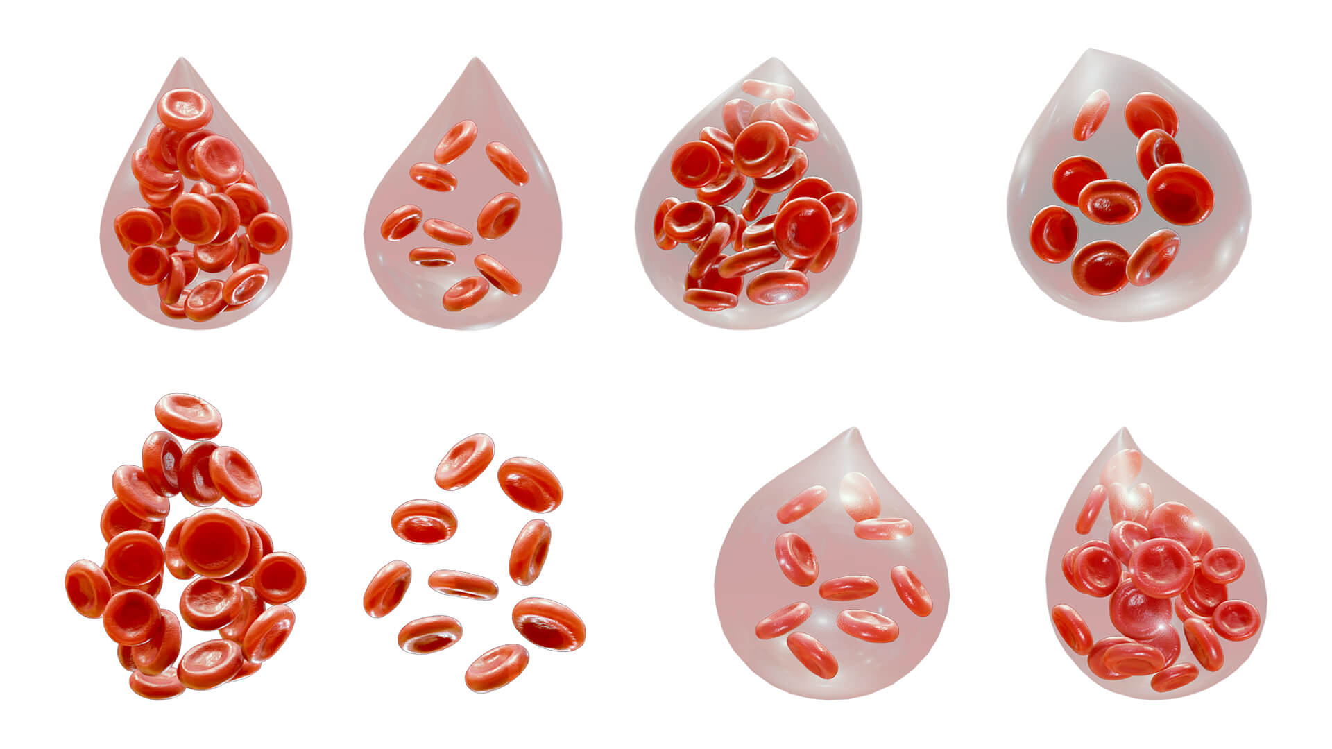 Normal Blood Cells Vs Anemia - 3D Model by h3ydari96