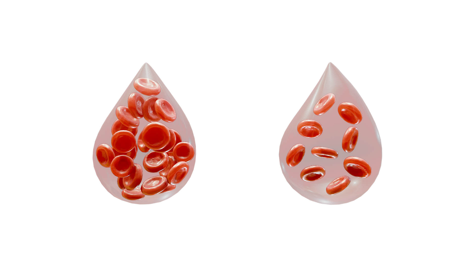 Normal Blood Cells Vs Anemia - 3D Model by h3ydari96