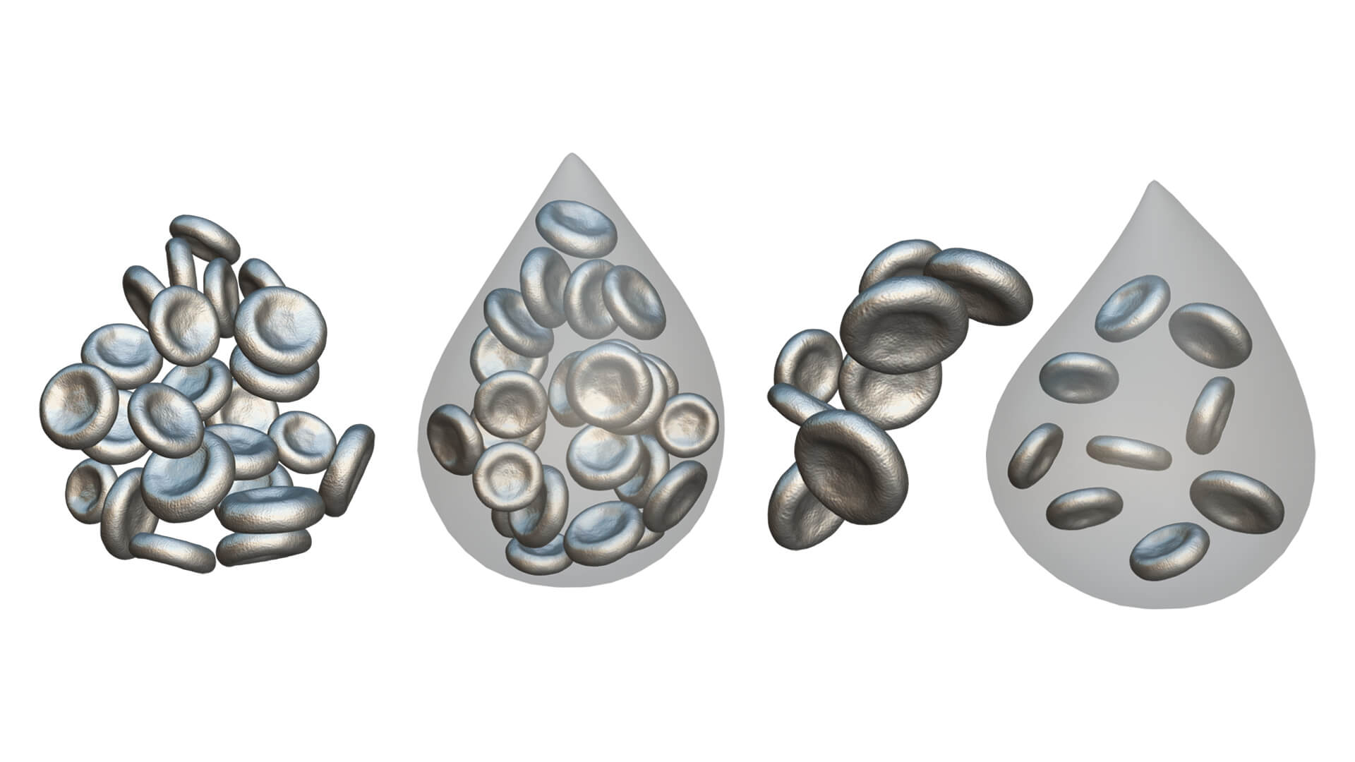 Normal Blood Cells Vs Anemia - 3D Model by h3ydari96